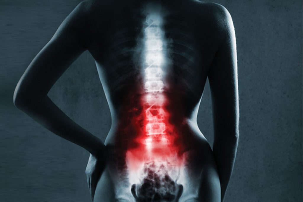 Chiropractic and Functional Medicine in Fayetteville, AR.